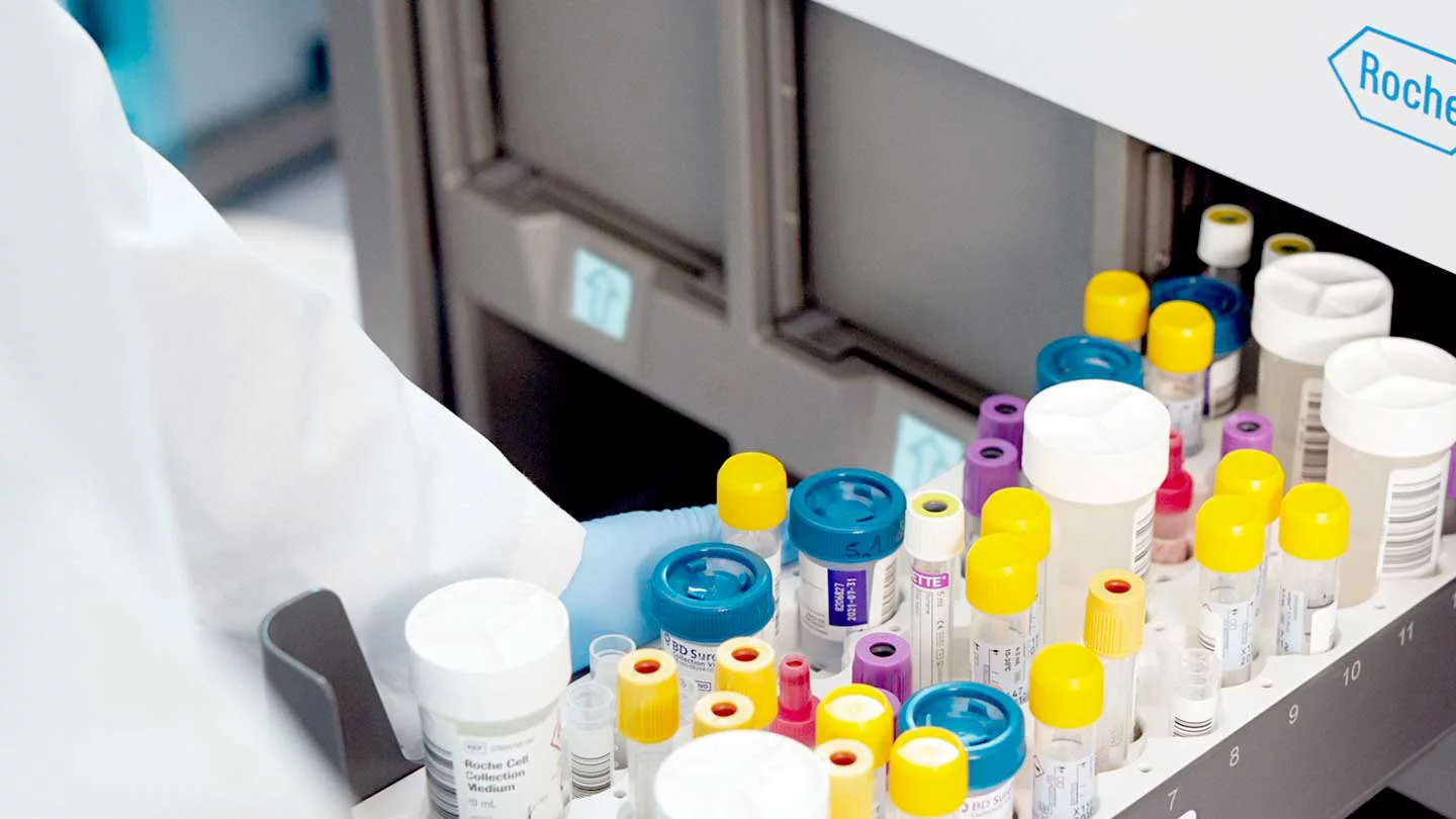 What Happens If You Don't Do Reagent Prime on Cobas: Critical Issues ...